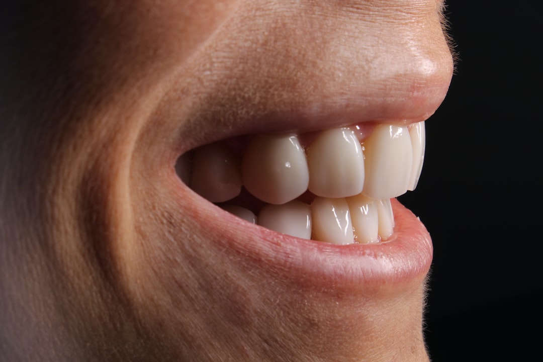 Escala De Color De Los Dientes: Encuentra El Tuyo Aquí