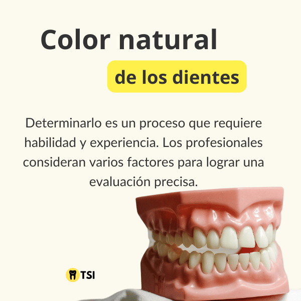 Escala De Color De Los Dientes: Encuentra El Tuyo Aquí